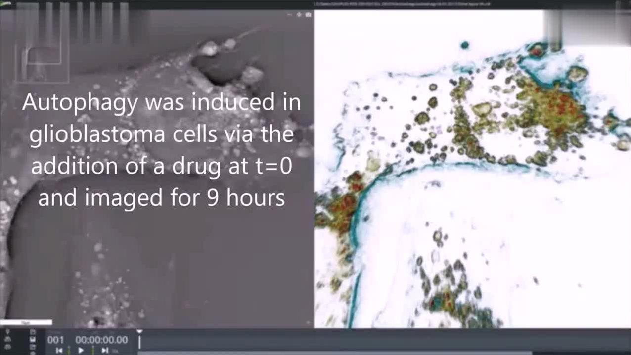 显微镜下的细胞自噬