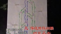 下肢静脉曲张注射疗法_标清