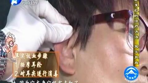 耳尖放血可以治疗耳轮发红,医生现场教授完整的治疗方法