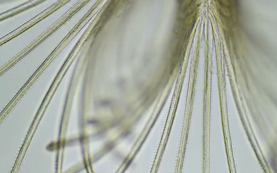 倒置生物显微镜观察拍摄淡水苔藓虫
