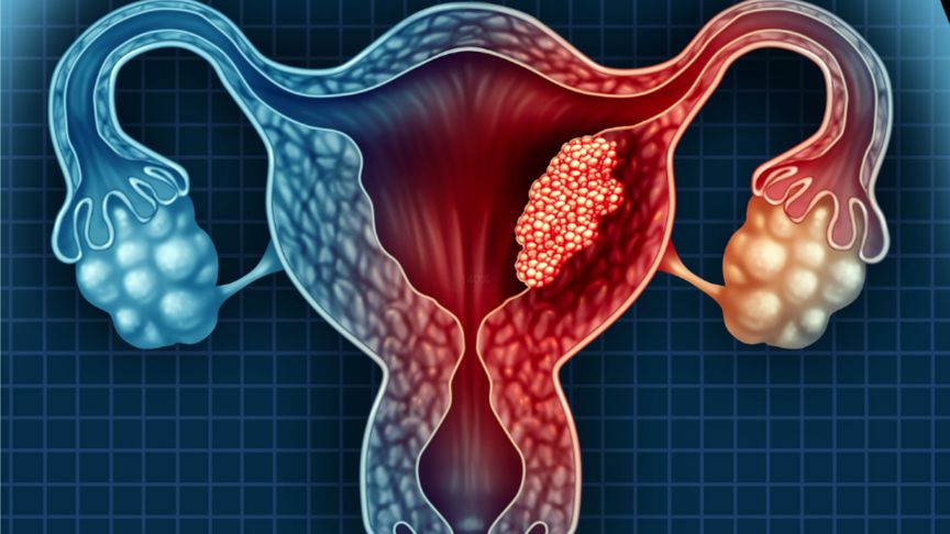 输卵管造影很痛?医生直言:其实看情况,主要会受到4个因素影响