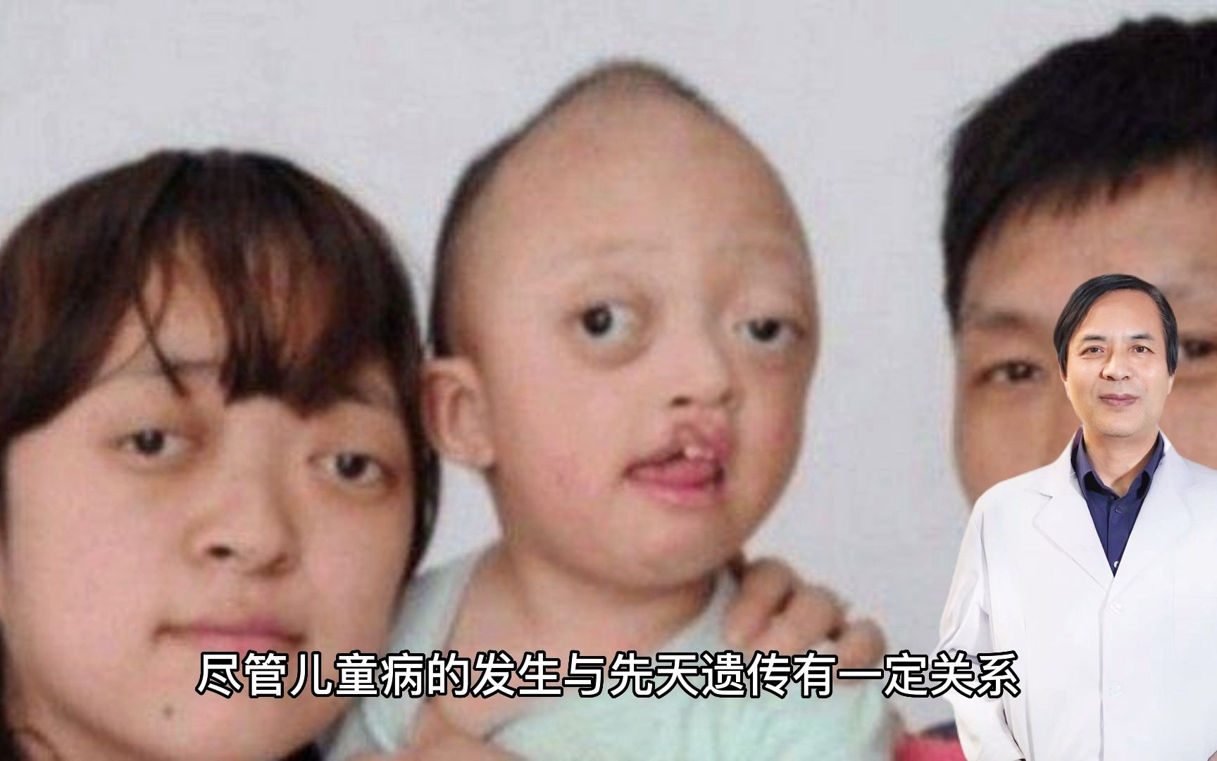 父母有糖尿病,孩子会遗传吗?如何远离儿童糖尿病。