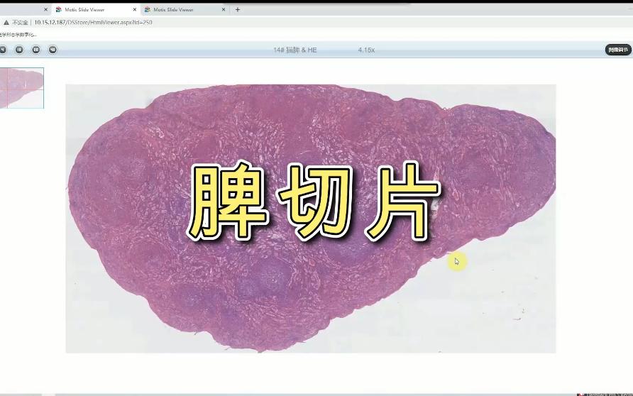 免疫-脾-组织切片解读