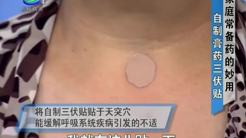 将三伏贴贴于肺俞穴,能宽中理气,降逆止咳的功效,很实用的