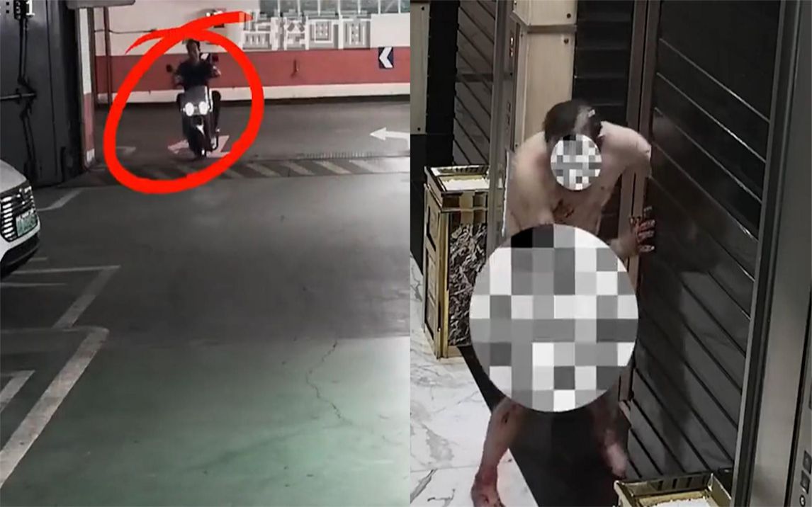 男子给电动车充电发生爆炸,全身炸伤浑身是血,皮一片片挂在身上