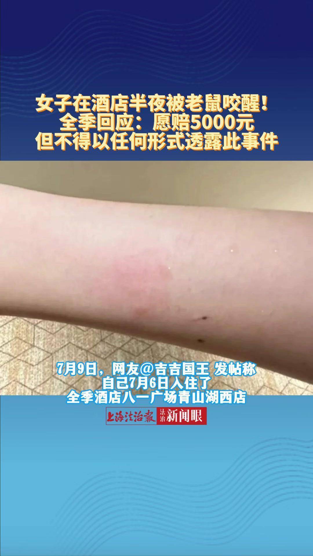 女子在酒店半夜被老鼠咬醒!全季回应:愿赔5000元但不得以任何形式...