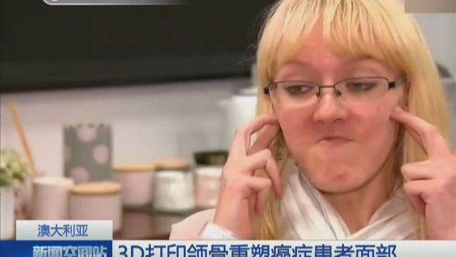 牙齿上方发现肿块,女子患癌取掉上颌骨,如今3D打印让她重拾信心