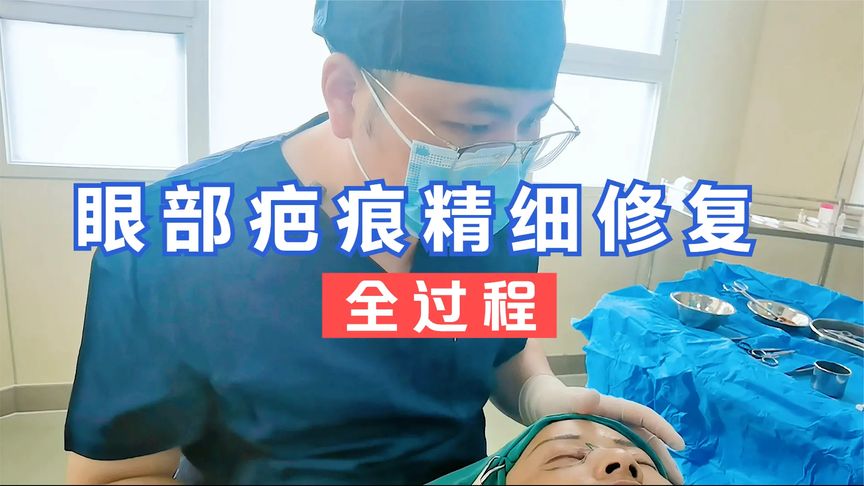眼部疤痕手术精细修复全过程