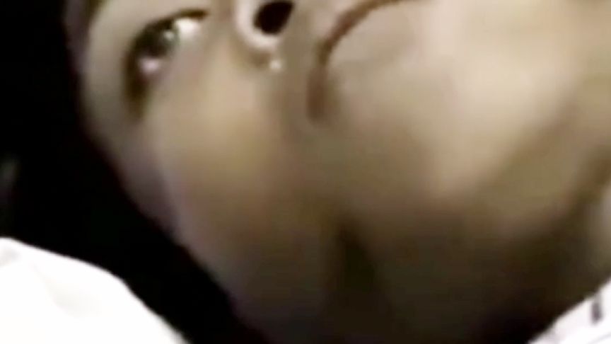 狂犬病发作真实情况,患者神志不清,怕光、怕水…