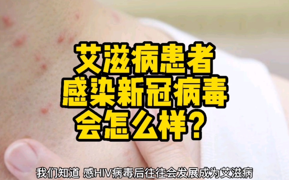 感染HI∨再感染新冠病毒,会怎么样?
