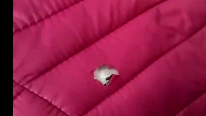 新买的羽绒服被烧了一个洞?修补方法超级简单,好省钱啊!