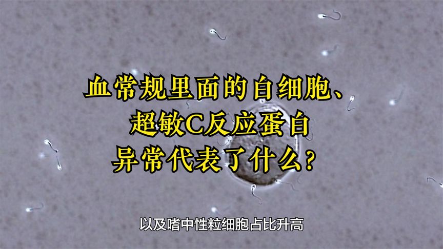 血常规里面的白细胞、超敏C反应蛋白异常代表了什么?