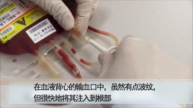 输血的操作流程及注意事项