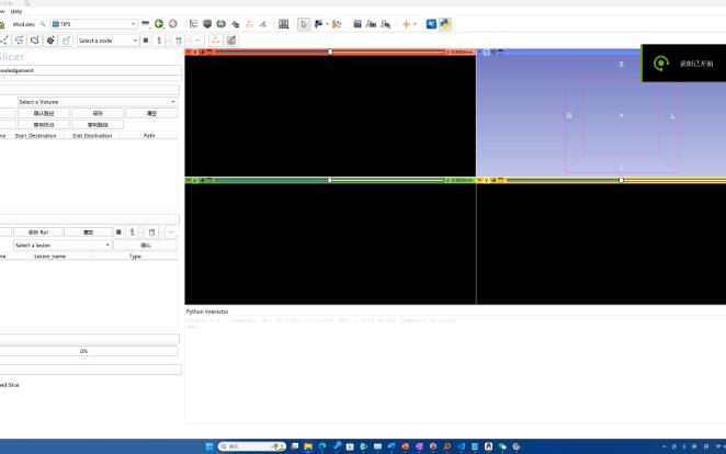 【3D Slicer】自制TIPS穿刺路径规划插件!同时可以标注肿瘤信息!