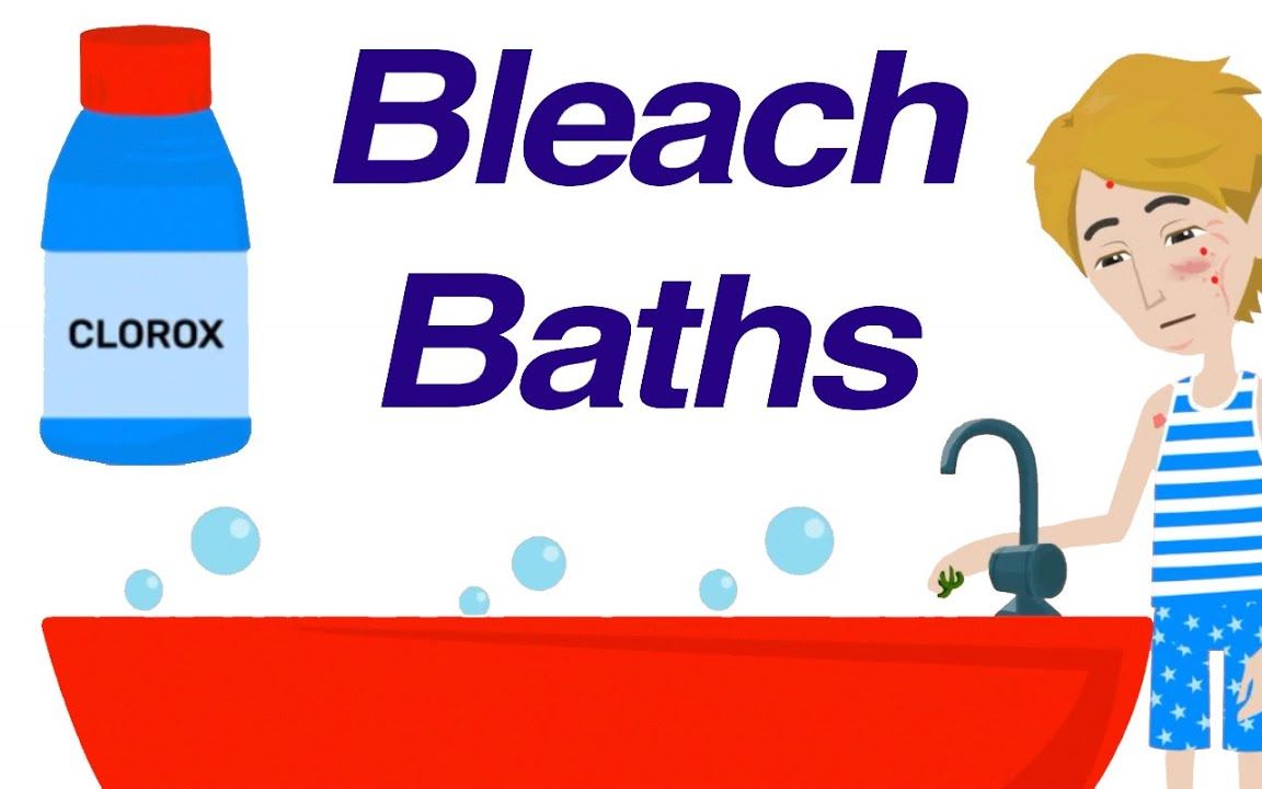 用于复发性皮肤感染的漂白浴