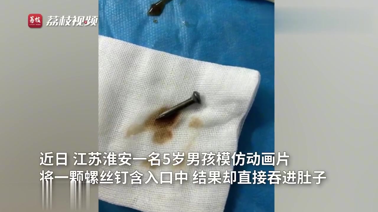 家长注意!五岁男孩模仿动画片不慎误吞螺丝钉