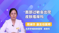 脸上过敏发红发痒怎么办?学会这几个皮肤过敏小妙招再也不怕了