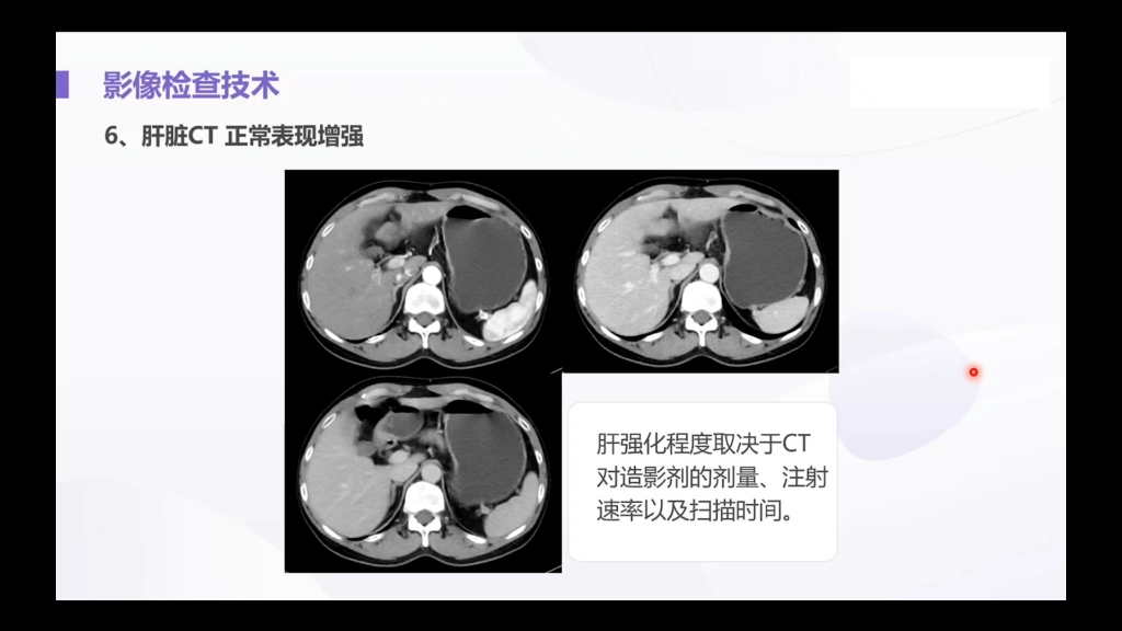 【陈伟教授-《腹部CT检查技术及正常解剖》