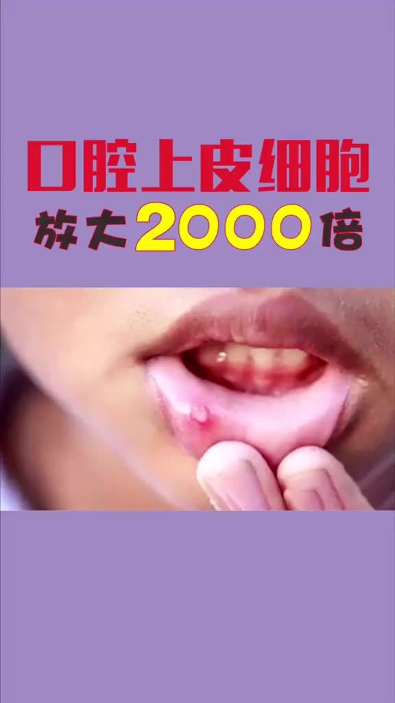 .口腔上皮细胞放大2000倍观察