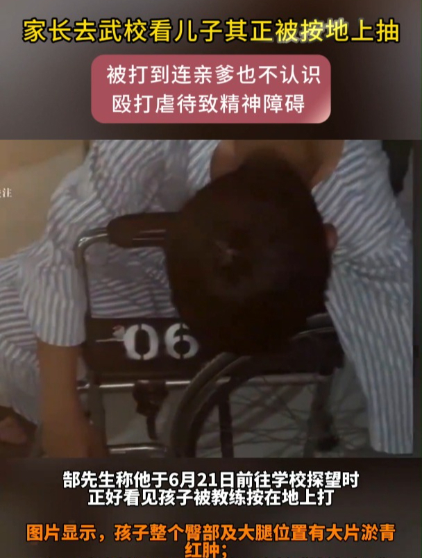嵩山少林塔沟武术学校男教练殴打虐待学生致精神障碍