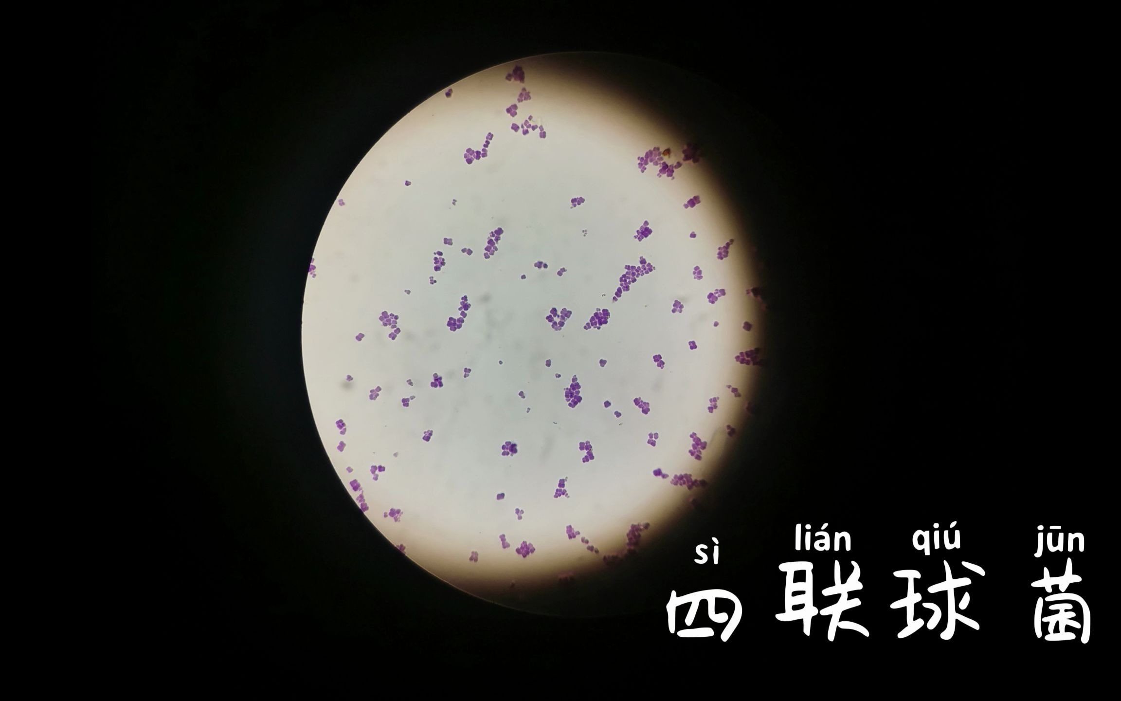 【微生物学】第一次实验_显微镜油镜观察三种细菌