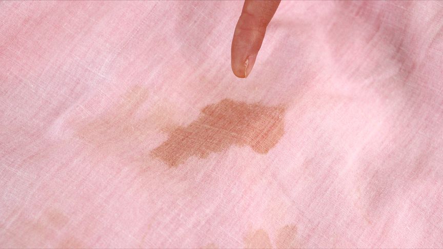 不管床单血渍多顽固,一个简单方法,新旧血渍都能洗得洁净如初