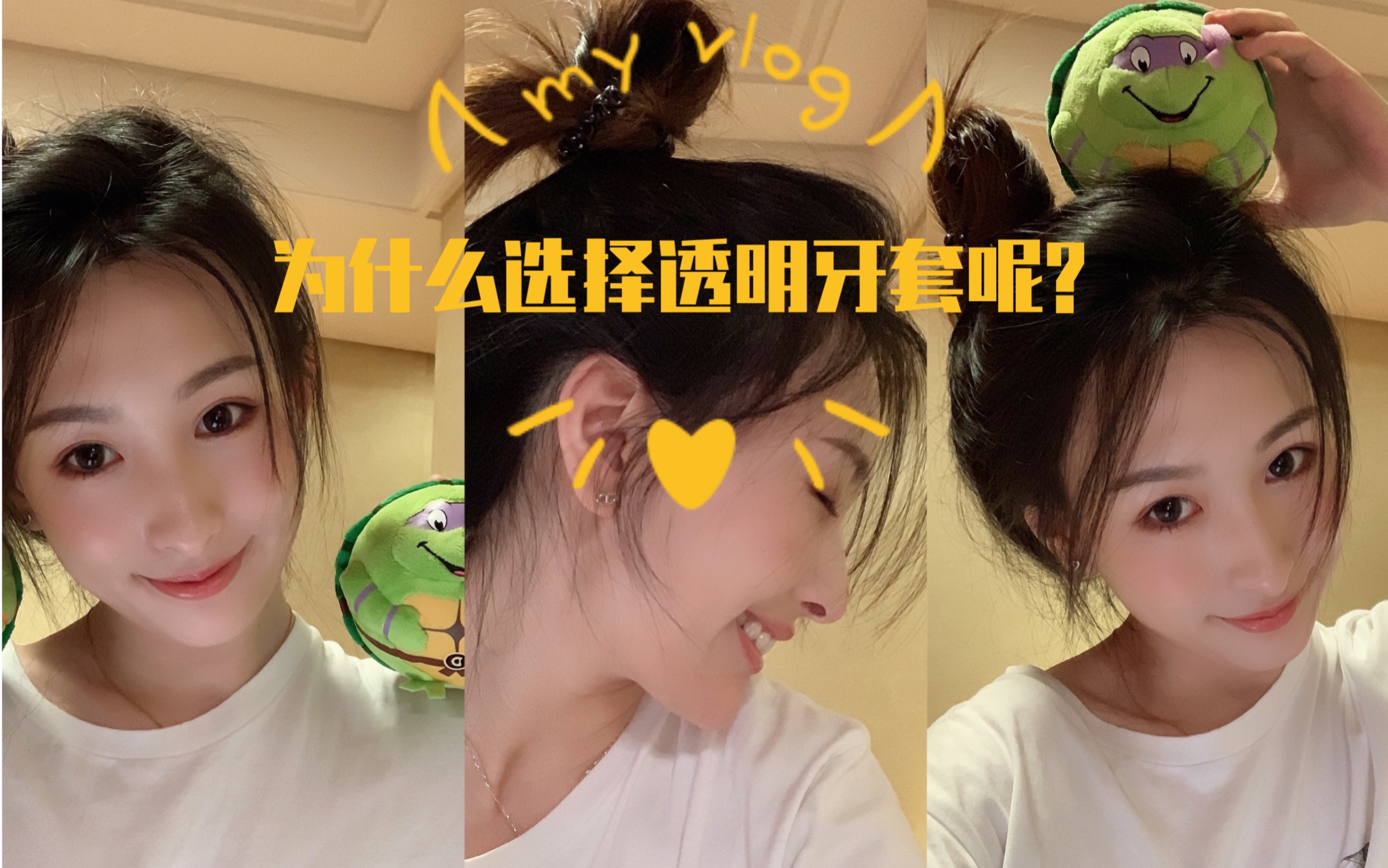 戴了五百多天透明牙套啦,来说说透明牙套的优点缺点吧～