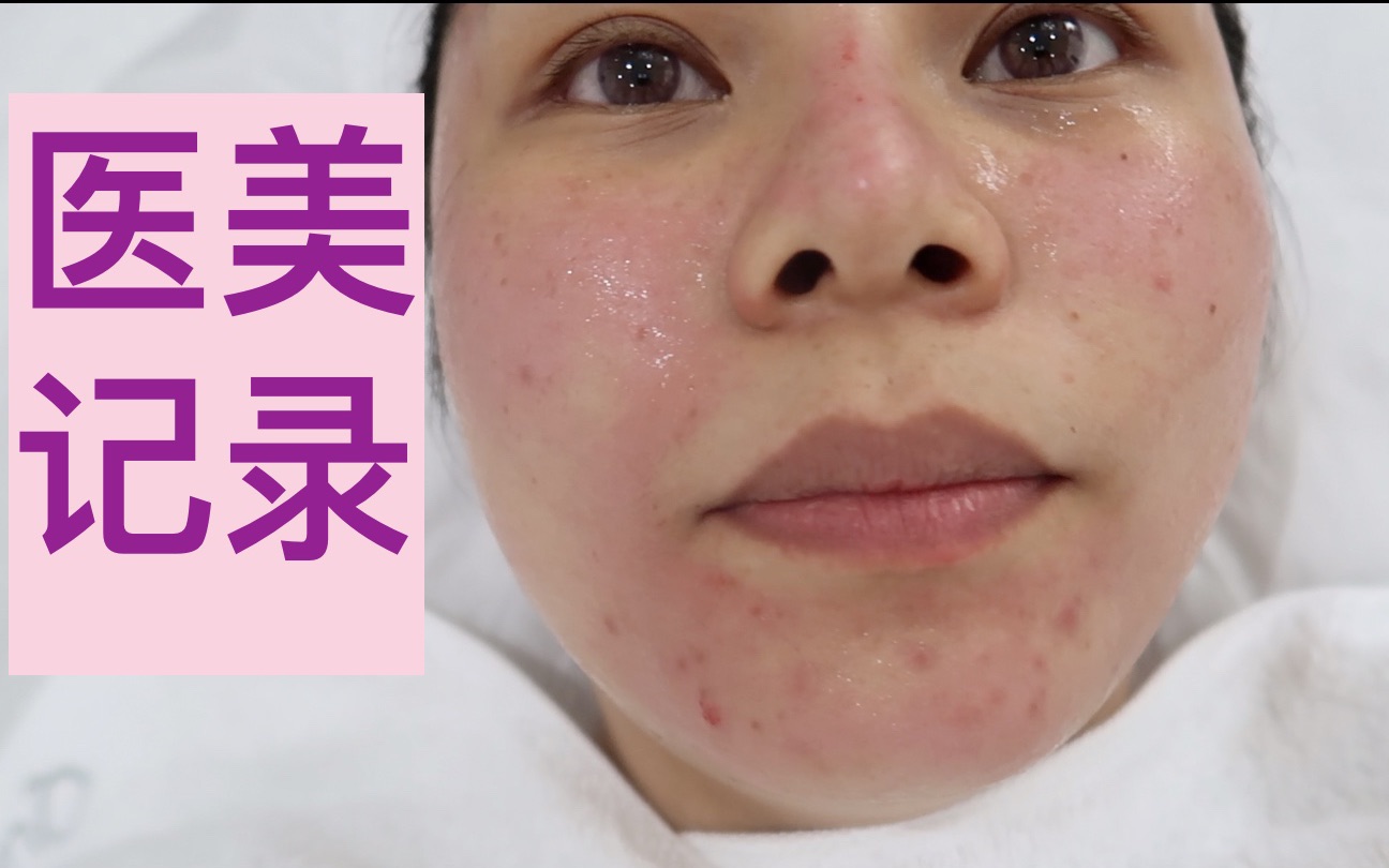 中胚层疗法一周记录vlog～和我一起做皮肤管理吧
