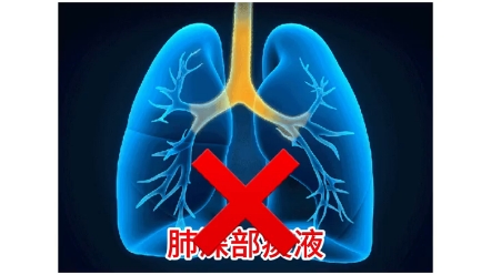 咳痰机和吸痰器有什么区别