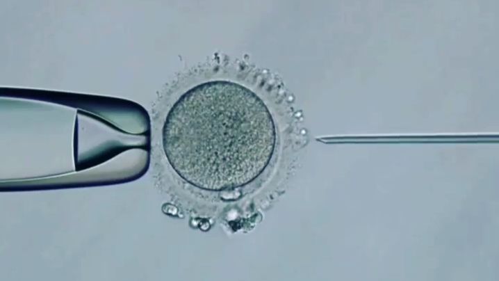 第二代试管婴儿显微受精全过程,其主要解决男方问题引起的不孕
