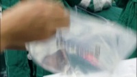 一次性脉冲冲洗器使用方法_盈诺医疗