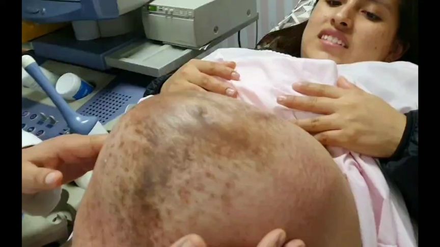 隔着一层薄薄的肚皮看胎动,生命太神奇了!