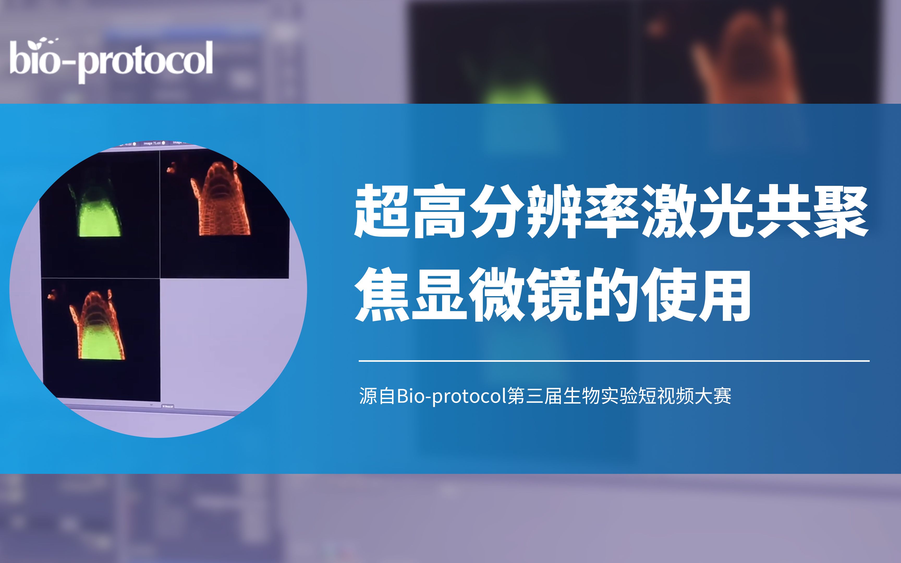 【短视频大赛】超高分辨率激光共聚焦显微镜的使用