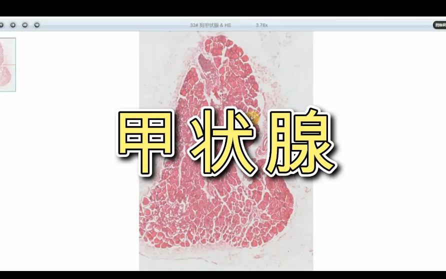 内分泌-甲状腺-组织切片解读