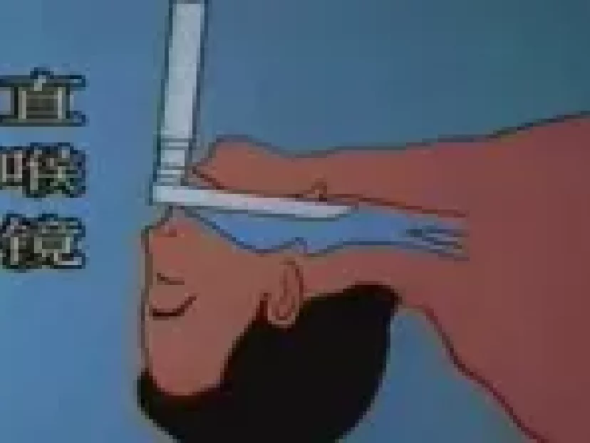 气管内插管术_标清