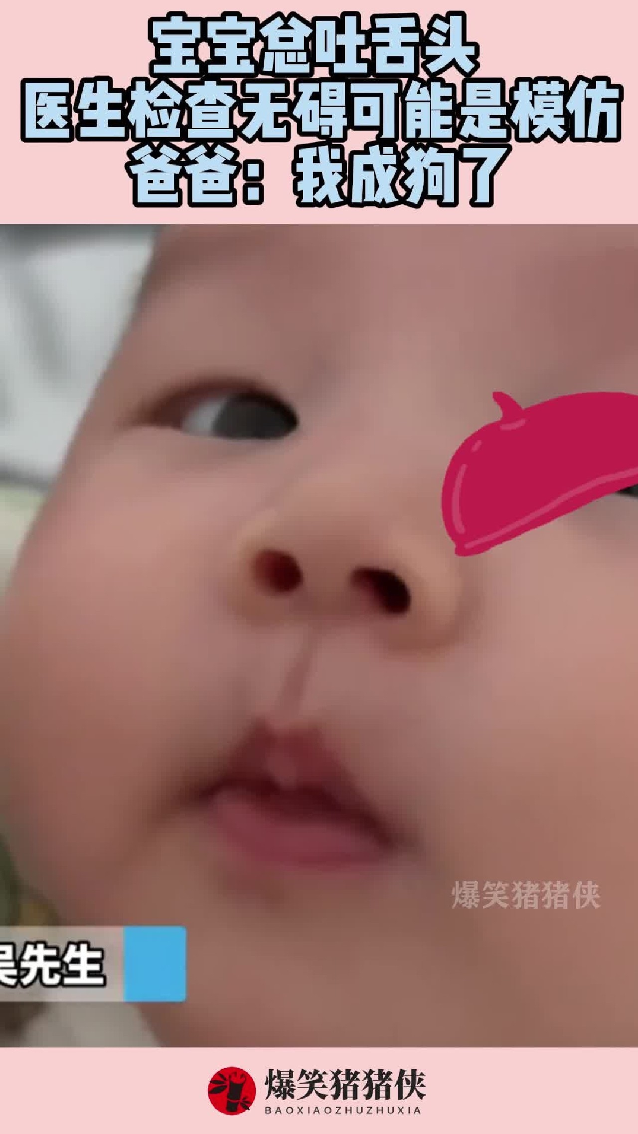 宝宝总吐舌头 ,医生检查无碍可能是模仿,爸爸:我成狗了!