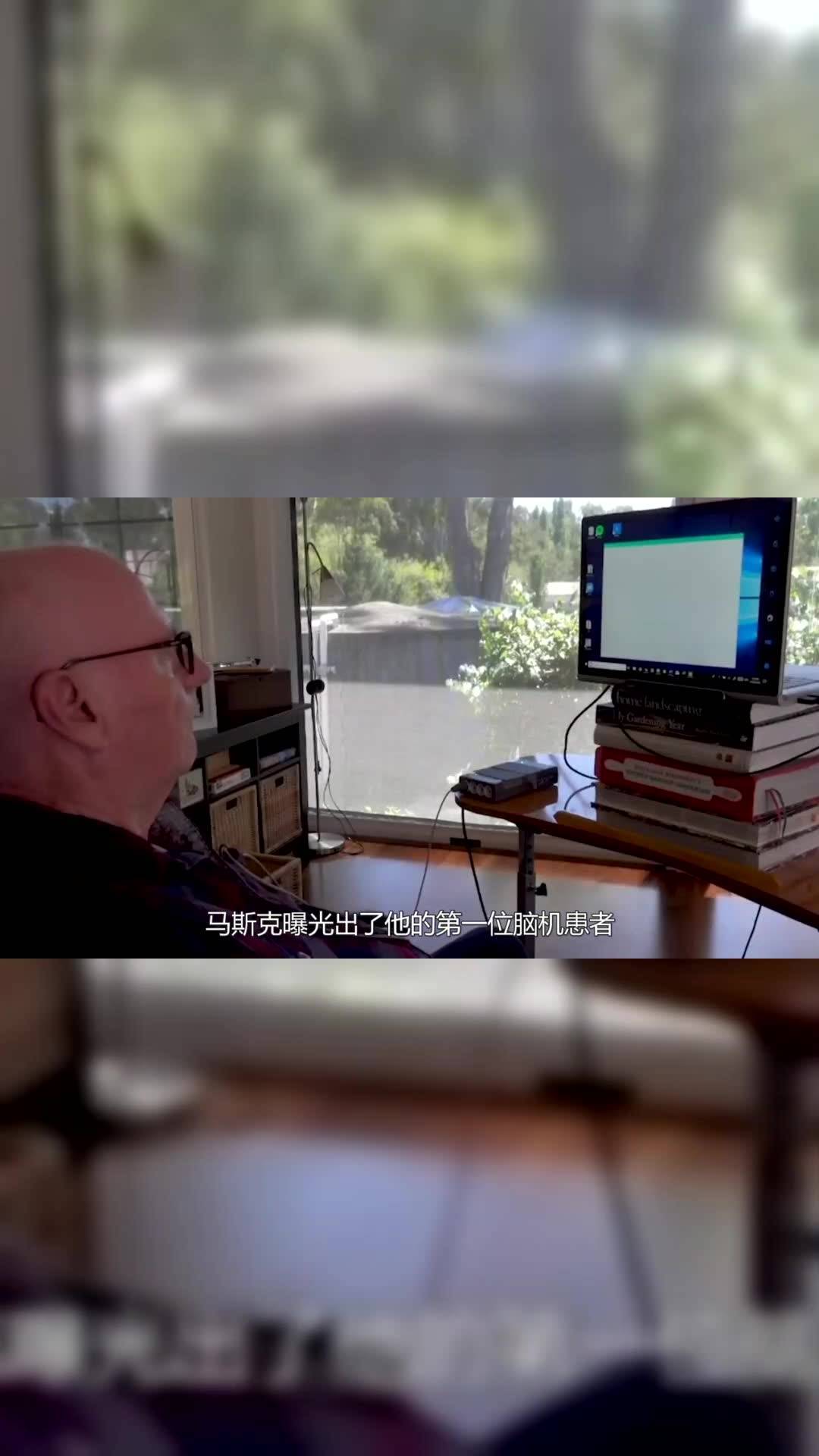 世界首位脑机接口患者,用意念控制移动鼠标!