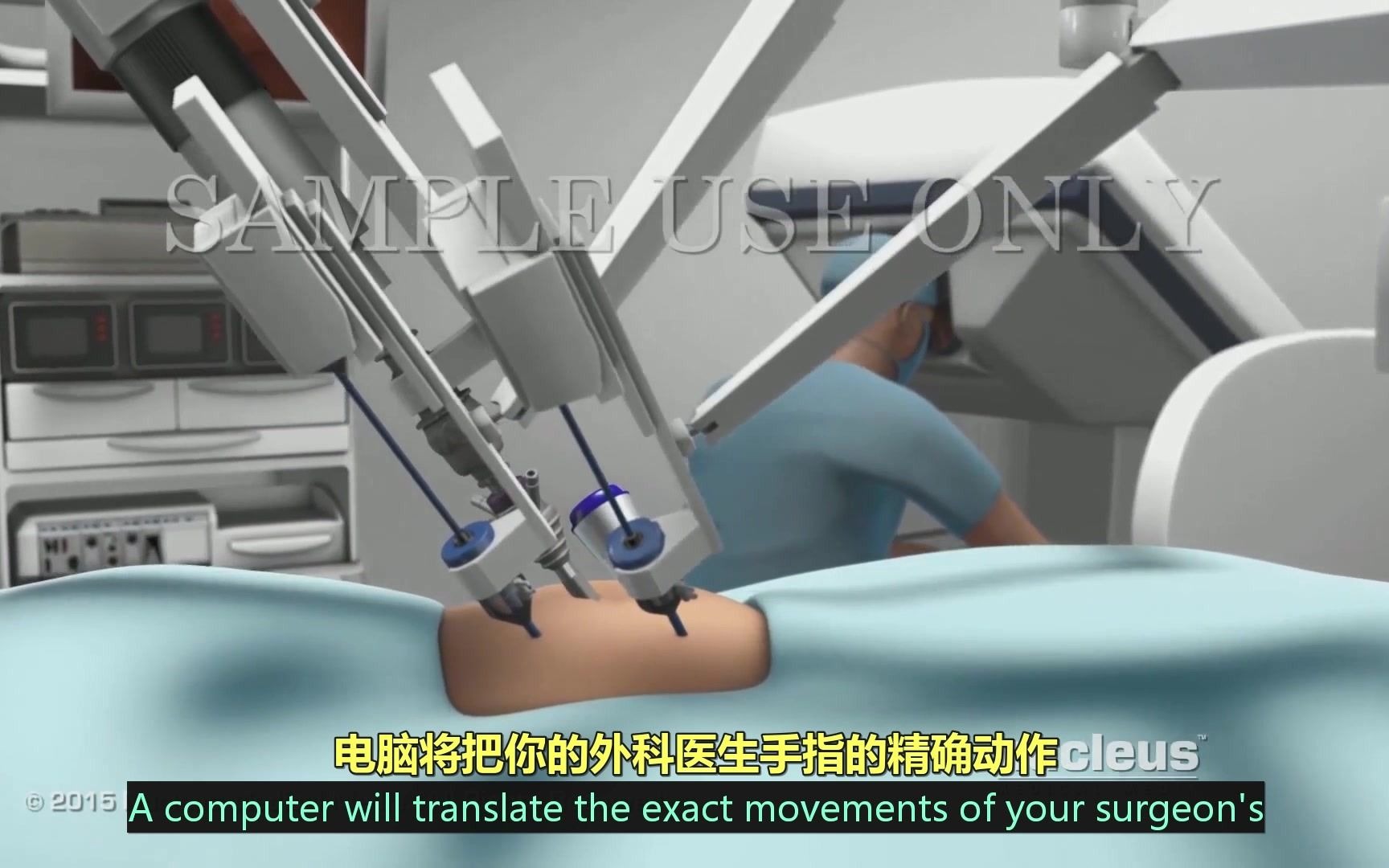 【3D医学动画】达芬奇机器人是如何切除子宫肌瘤的(中英双字幕)