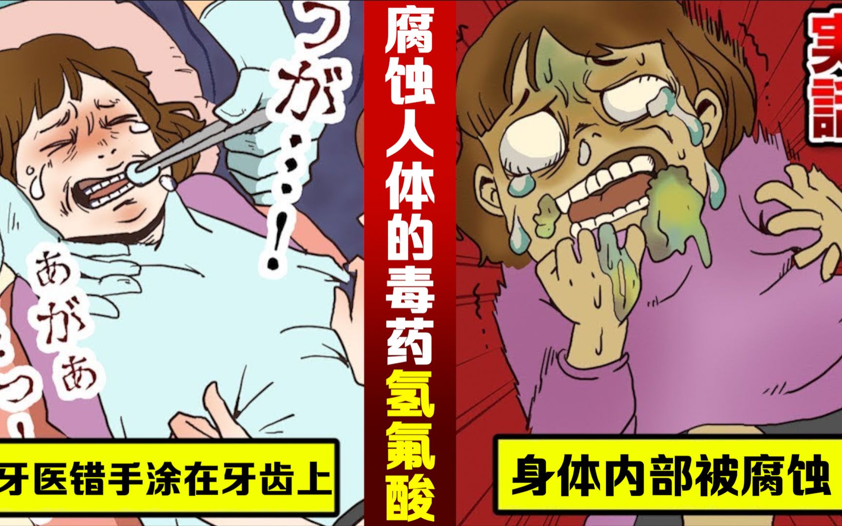 【真事】牙医引发医疗事故。把世界上最可怕的毒药涂在3岁小孩的...