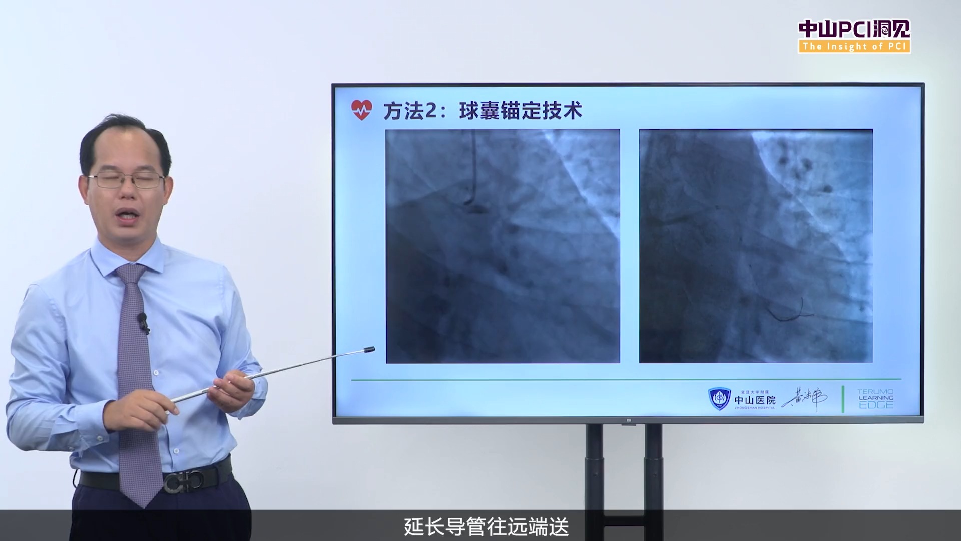 中山PCI洞见|86. 延长导管,如何输送到位?
