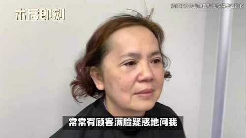 揭秘去眼袋手术真实价格!别再被坑了