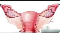 宫腹腔镜是如何治疗输卵管性不孕的-不怀孕的原因