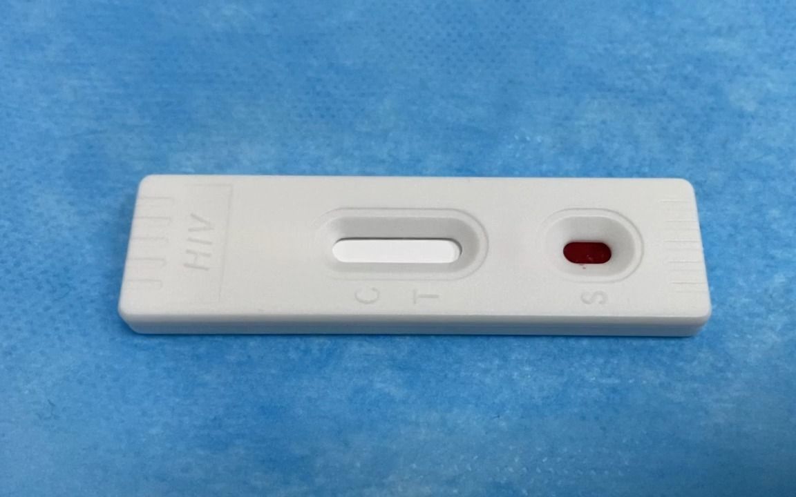 如果这是你的检测结果,你会如何面对?