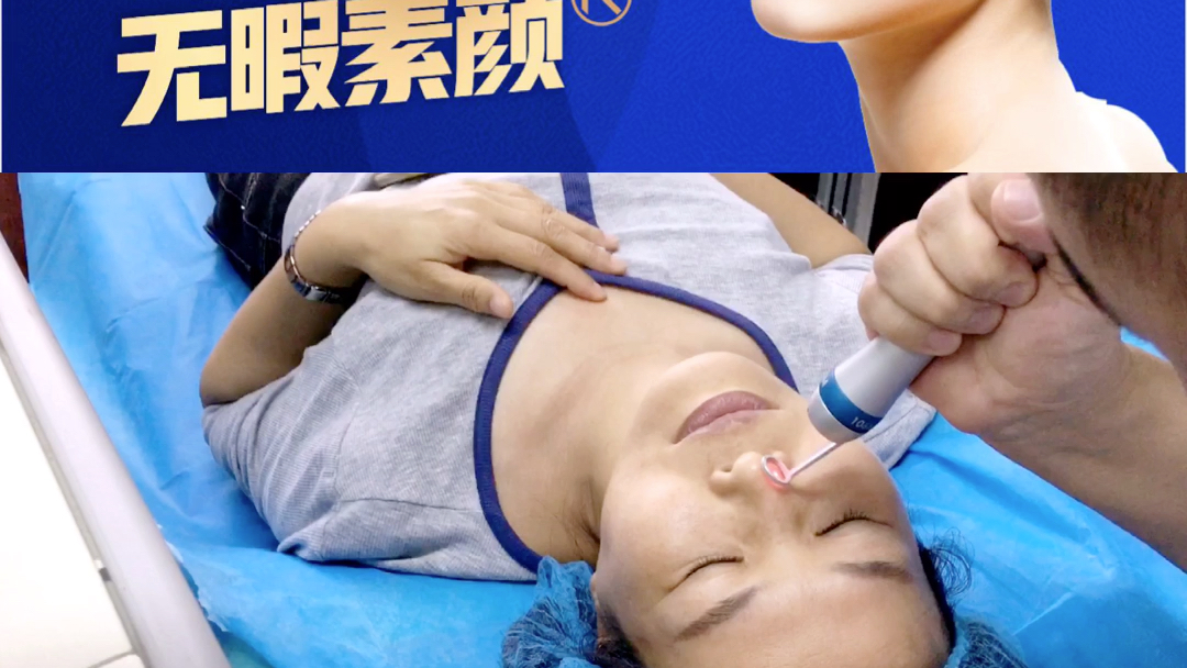 Pioway超皮秒平扫美白、改善面部皮肤(许昌德医堂)#一句话科普##...