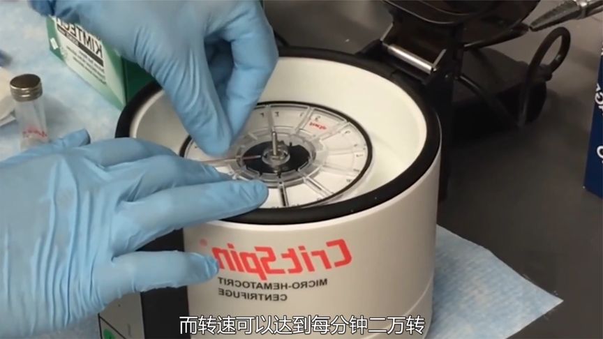 牛人用一张纸造出“离心机”,90秒内分离血浆,成本不到2块钱