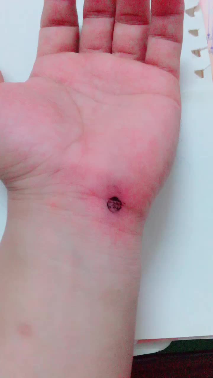 神门穴位置,用掐揉法效果好