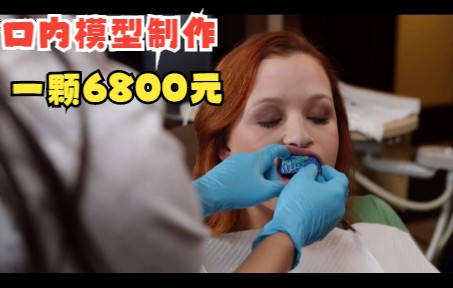 牙医现场示范,如何为患者的牙齿做模型?
