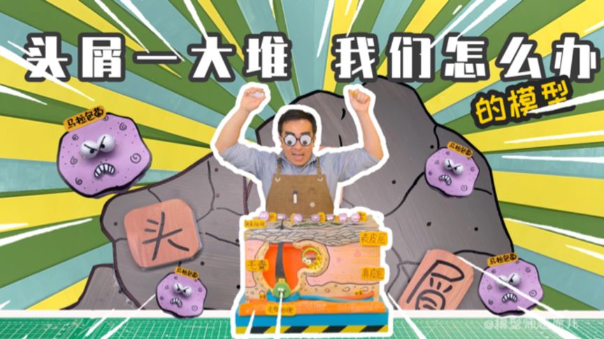 头皮油乎乎、头屑连成块?头屑顽固反反复复,到底咋回事?