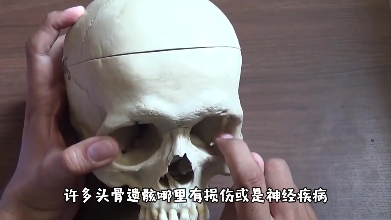 揭秘史前人类开颅手术:考古学家挖出7000年前开颅头骨!比刮骨吓人?