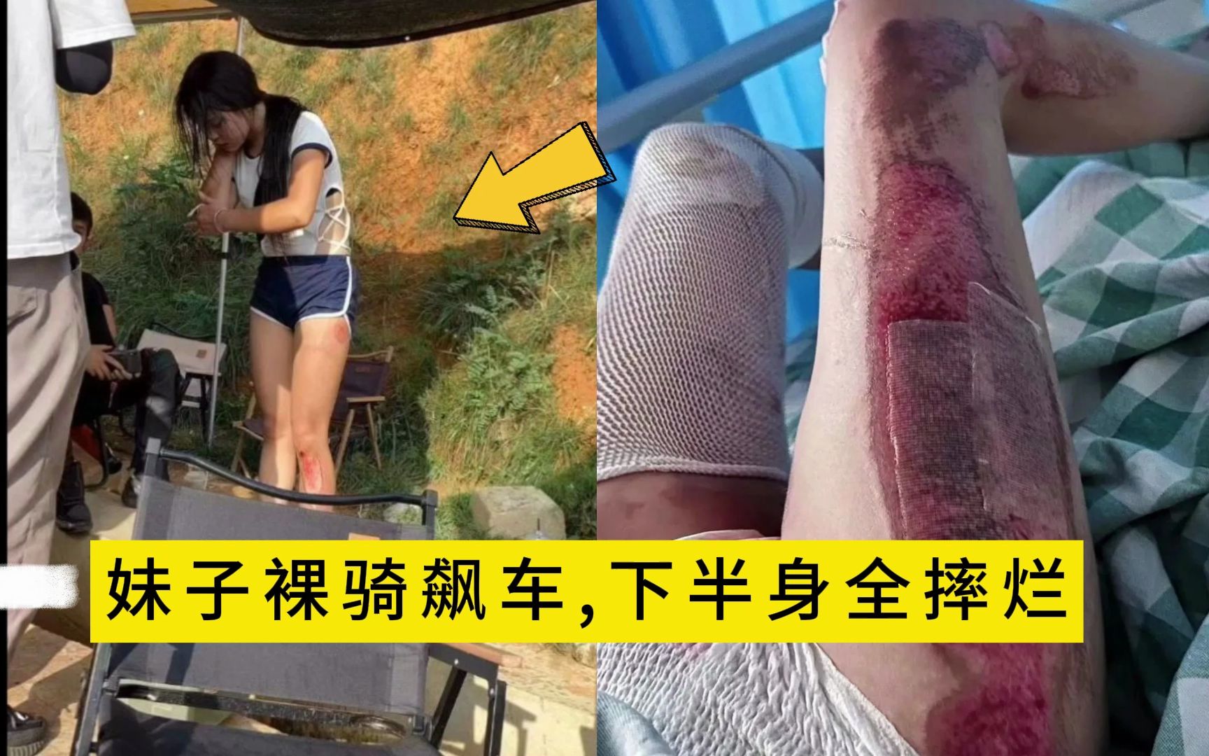 妹子裸骑飙车,当场下身全摔烂了,太惨了